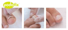 Podofix-Spange Medium / 8 Stück - IMGRO Beauty
